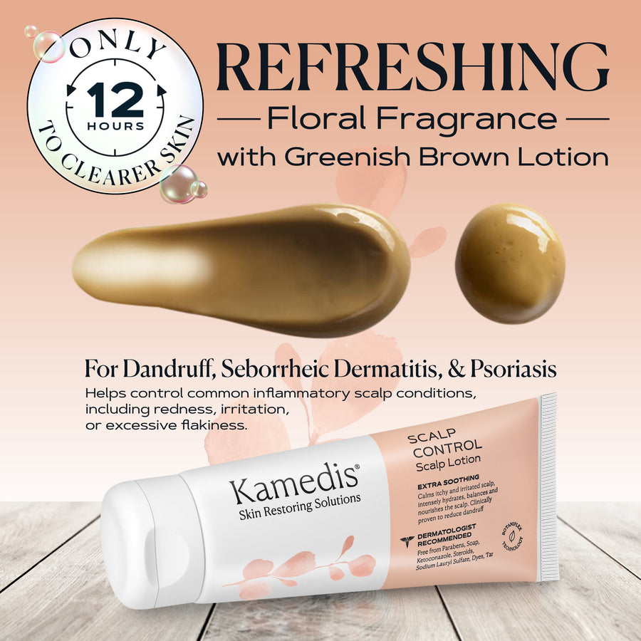 Scalp Lotion | Dandruff & Scaly Scalp Seborrheic Dermatitis Treatment ...